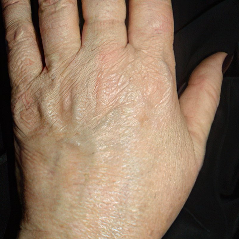 Treatments - Dermaworld