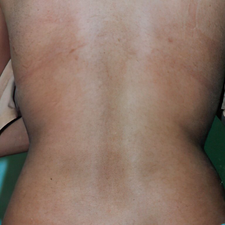 Treatments - Dermaworld